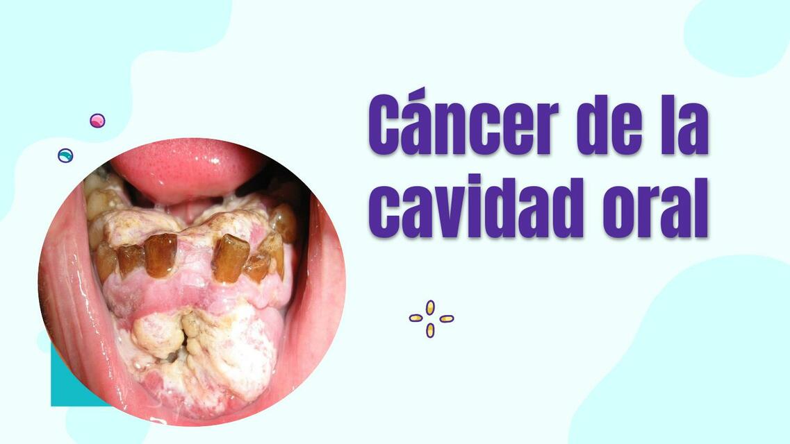 Cáncer cavidad oral | Apuntes Medicos | uDocz
