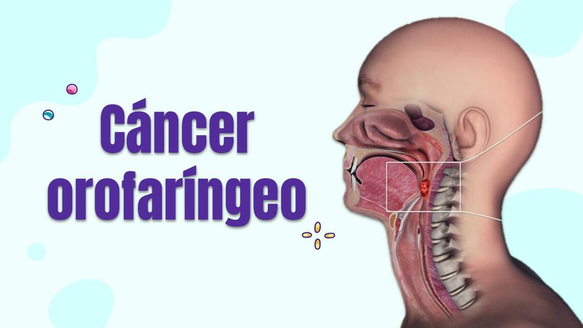 Cáncer orofaríngeo | Apuntes Medicos | uDocz
