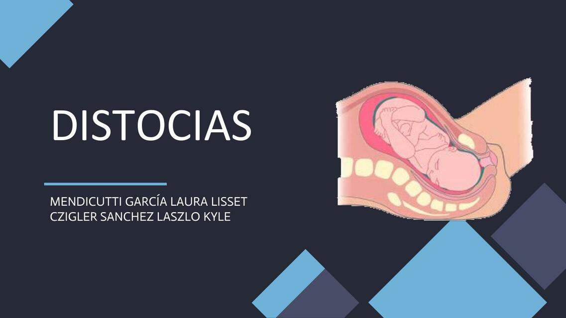 Distocias Parto pélvico | Xochitl Caro Monroy | uDocz