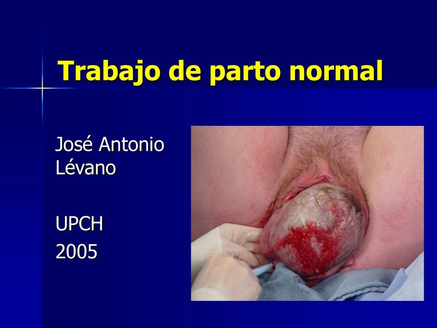 Parto normal | DANILO ALDO BALTAZAR CHACON | uDocz Parto normal | DANILO ALDO BALTAZAR CHACON | uDocz