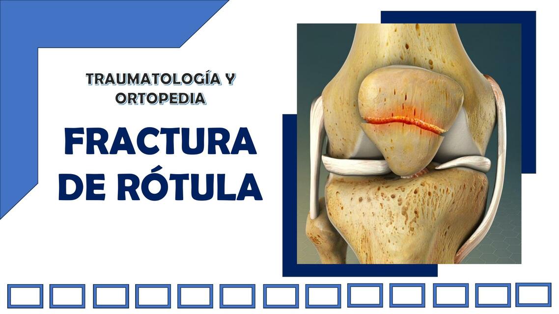 FRACTURA DE ROTULA | Mis apuntes de Medicina | uDocz