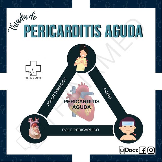 TRIADA DE PERICARDITIS AGUDA | ThinkMed | uDocz