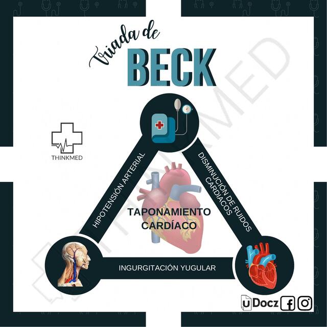 TRIADA DE BECK | ThinkMed | uDocz