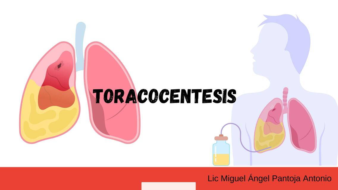 TORACOCENTESIS | Miguel Ángel | uDocz