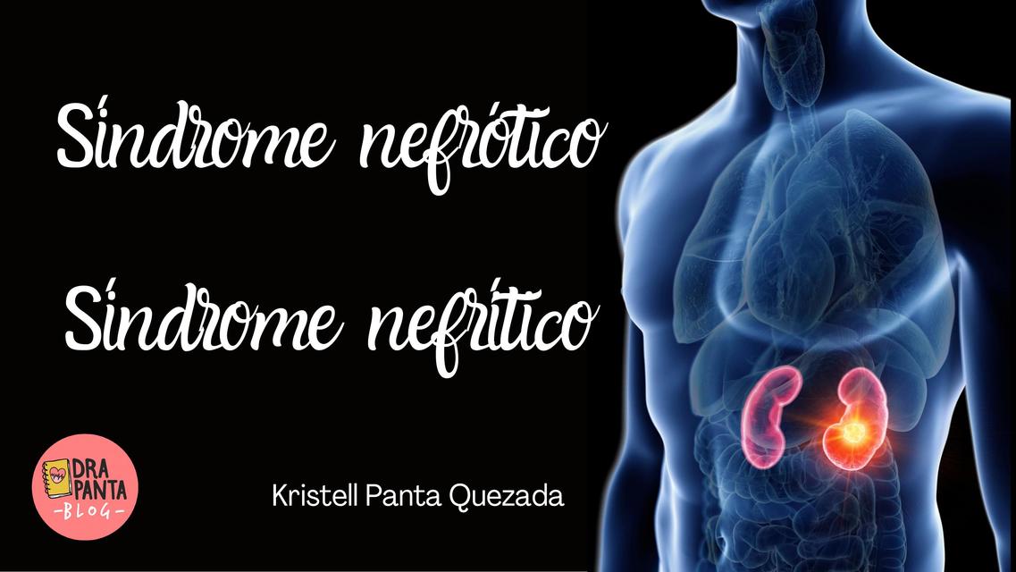 SÍNDROME NEFRÍTICO Y NEFRÓTICO - SEMANA MÉDICA INTERNACIONAL | Síndrome ...