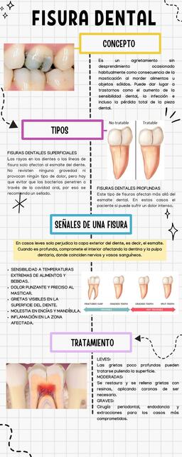 Infografía FISURA DENTAL y FRACTURA DENTAL | Yami Narciso | uDocz