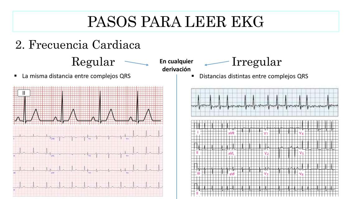 FRECUENCIA CARDIACA EKG | Doctor_teco | uDocz