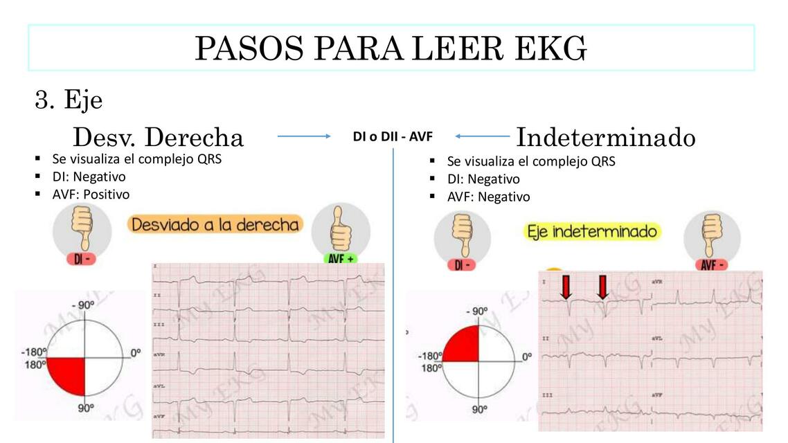 EJE CARDIACO DESV DERECHA INDETERMINADO | Doctor_teco | uDocz