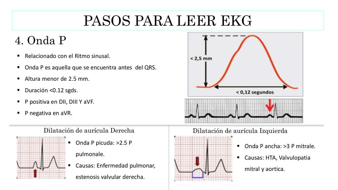 ONDA P EKG | Doctor_teco | uDocz