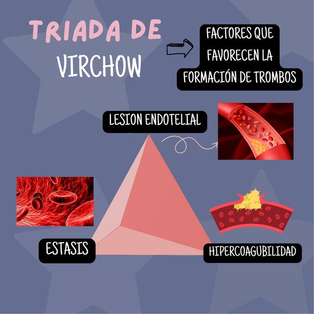 Triada de Virchow | Shantalle | uDocz