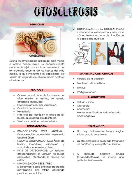 Otosclerosis | uDocz