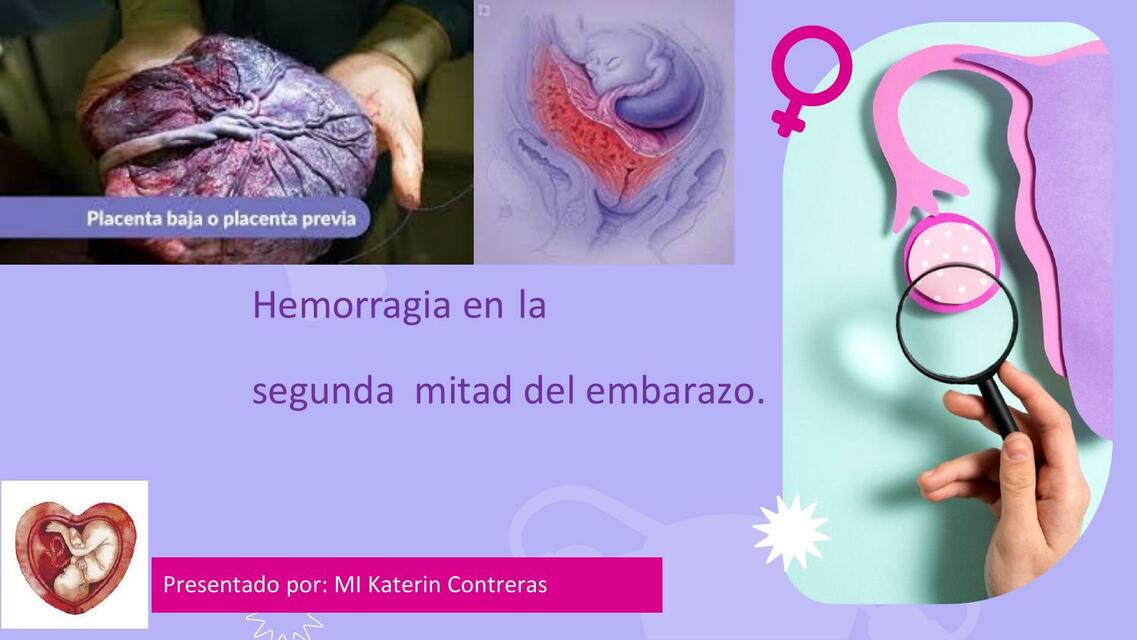 hemorragia | Fernando | uDocz