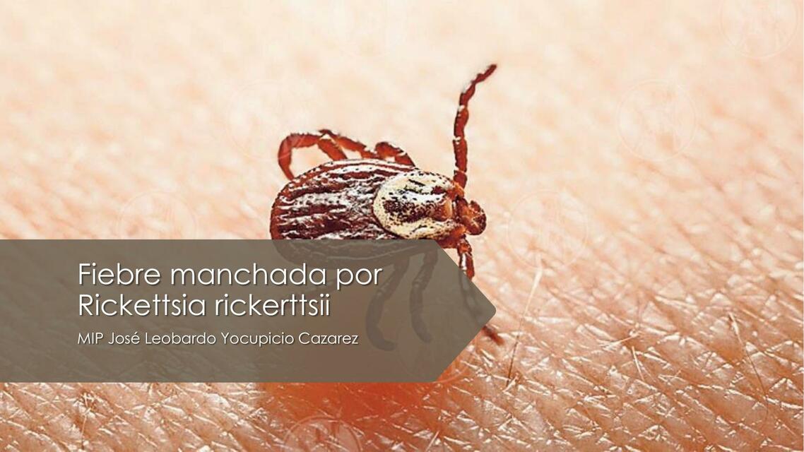 Resúmenes de Fiebre Manchada | Descarga apuntes de Fiebre Manchada