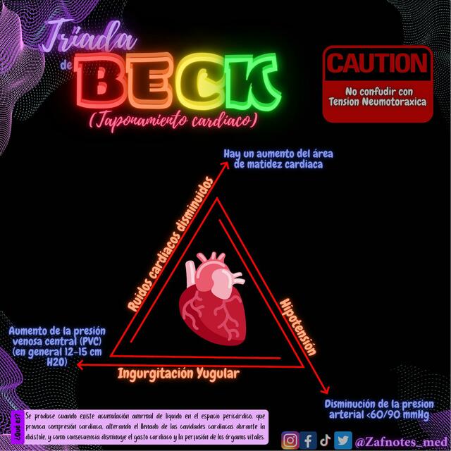 Triada de Beck | Yuleisy Roque Garcia | uDocz