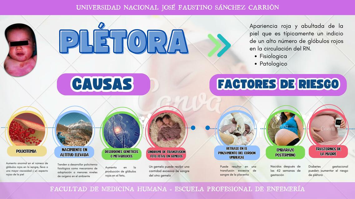 Plétora en recien nacidos | Linda Milena León Gómez | uDocz