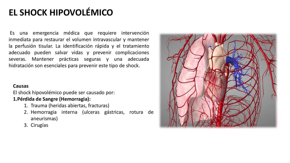 shock hipovolemico | B.M.GFisioterapia Apuntes y demás | uDocz shock hipovolemico | B.M.GFisioterapia Apuntes y demás | uDocz