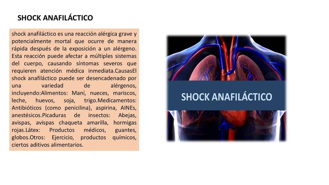 Flashcards de shock anafilactico | Por B.M.GFisioterapia Apuntes y ...