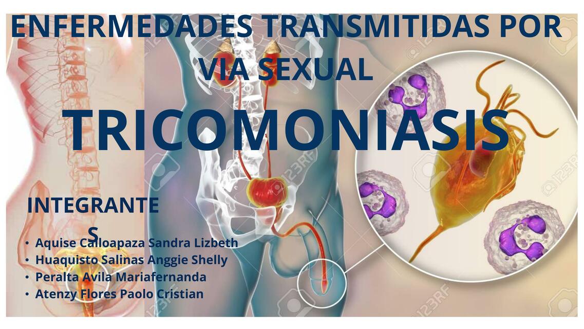 Tricomoniasis | Anggie Shelly | uDocz