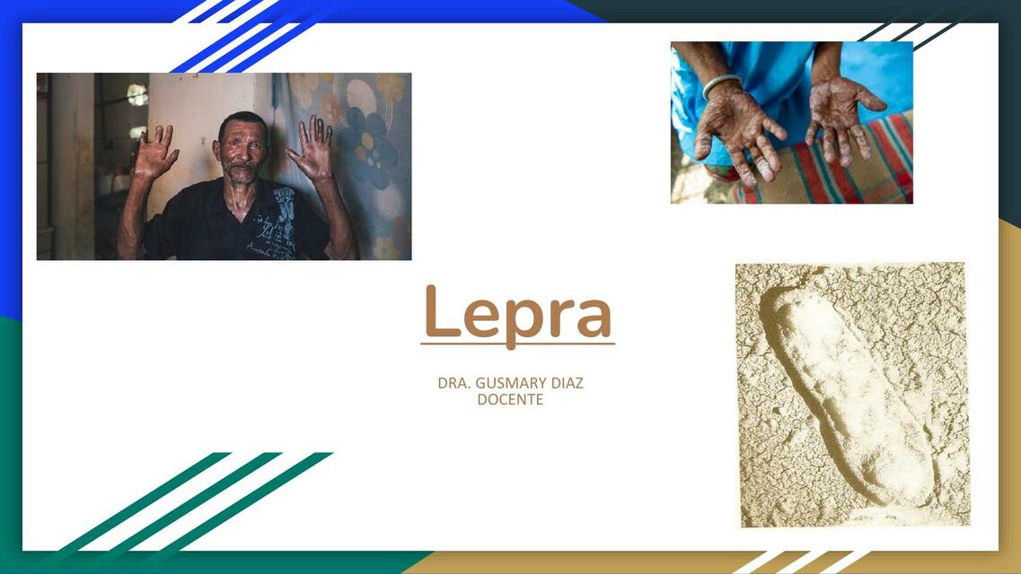 LEPRA | Franklin robles | uDocz