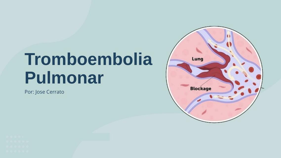 Tromboembolia Pulmonar | ElJoeCerrato | uDocz