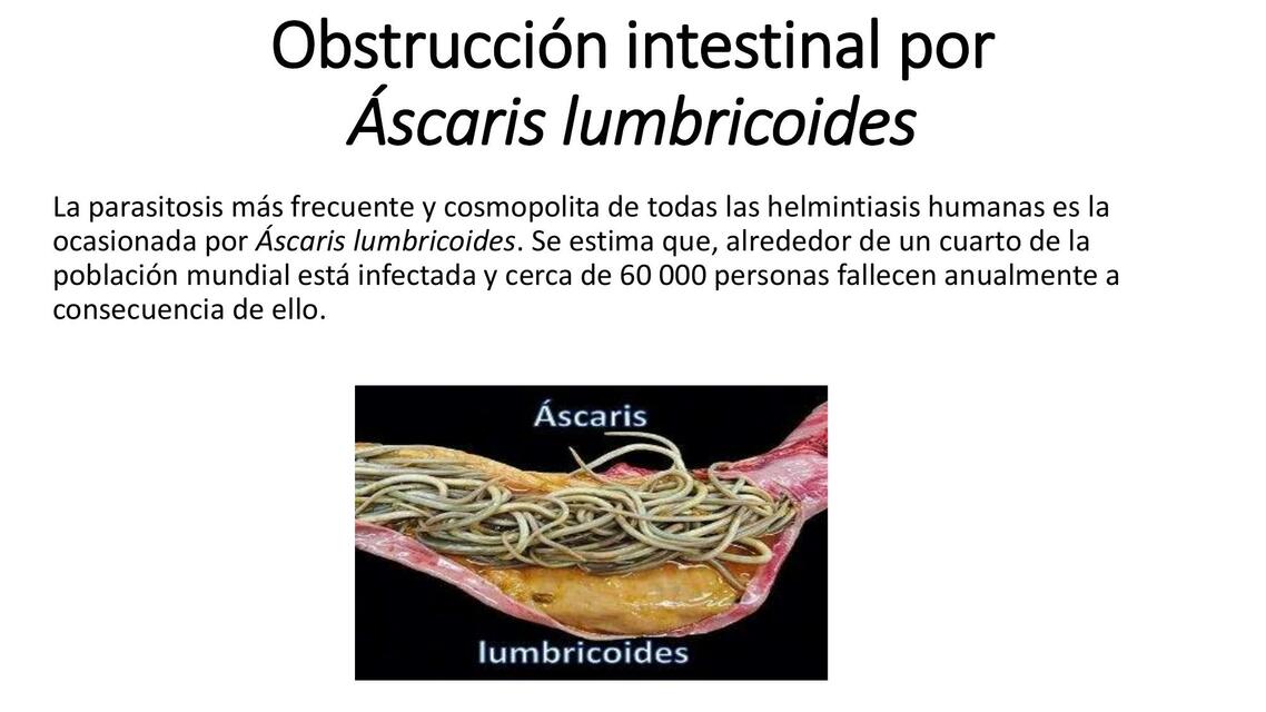 Obstrucci n Intestinal Por scaris Lumbricoides Daniela Manrique Obstrucci n Intestinal Por scaris Lumbricoides Daniela Manrique