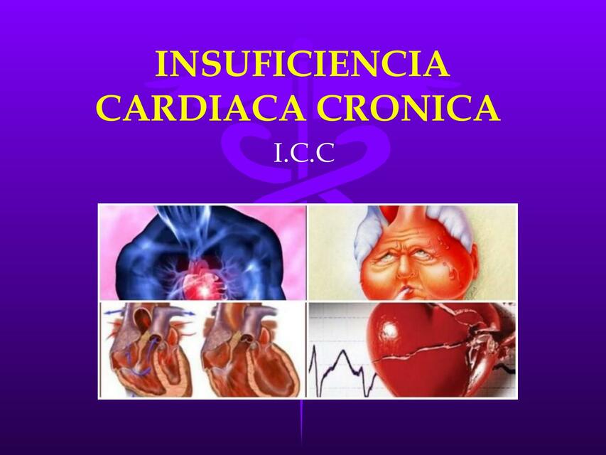 Insuficiencia Cardiaca Cronica | Anabela Gatani | uDocz