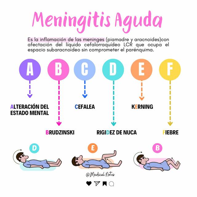 Meningitis Aguda | MEDICAL NOTES | uDocz