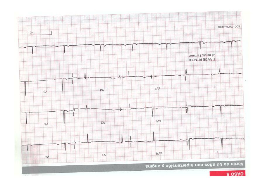 Ejercicios de EKG | Ricardo Gutiérrez García | uDocz