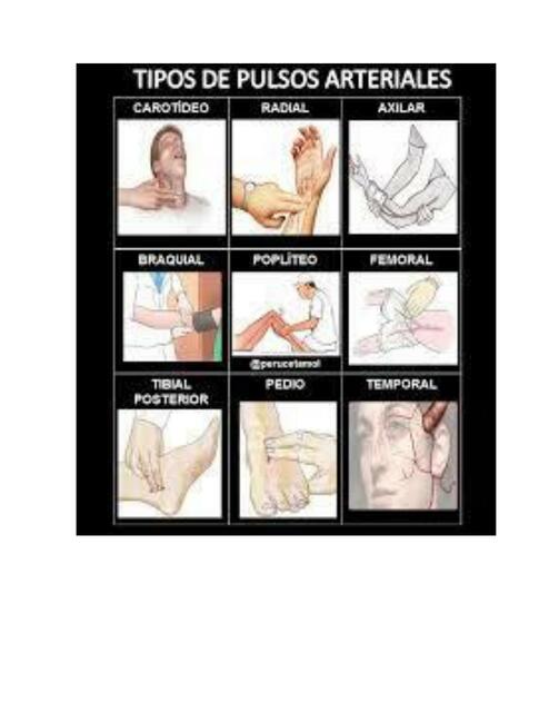 PRÁCTICA 6 PULSO RADIAL TIPOS 1 | FABIANA | uDocz