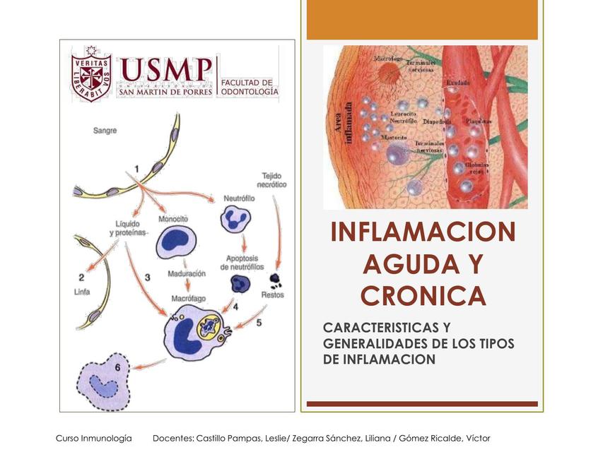 Inflamacion Aguda y Cronica | Douglass @dr.douglassjaime | uDocz