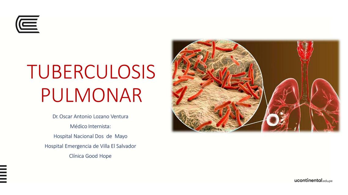 teoria TBC 1 | ALEXANDRA YERDIN HERRERA MEZARINA | uDocz