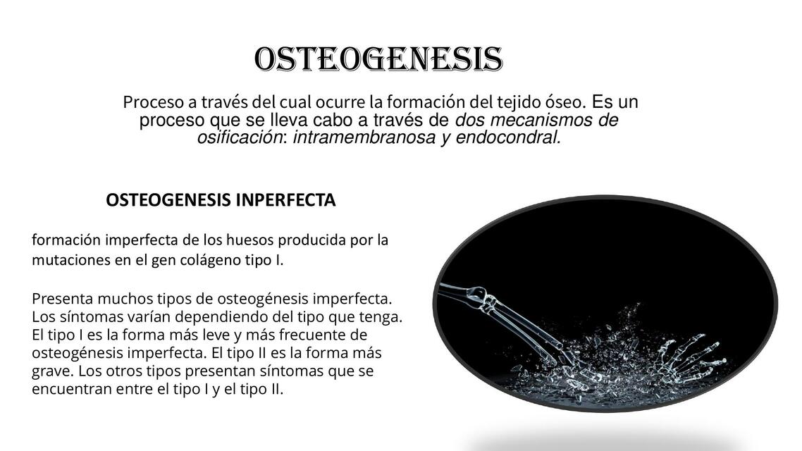 OSTEOGENESIS | Danelin Barrios | uDocz