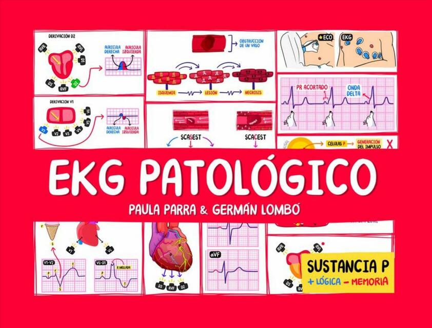 toaz info electrocardiograma ecg ekg patologico pa | Laura Vega | uDocz