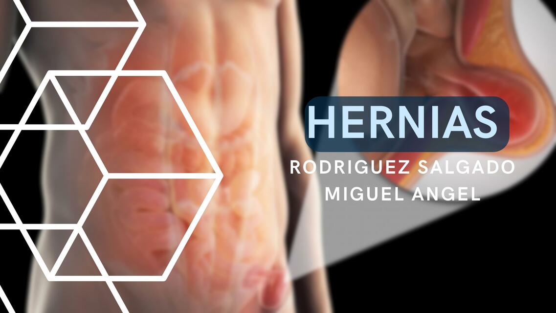 hernias | Miguel Rodriguez Salgado | uDocz