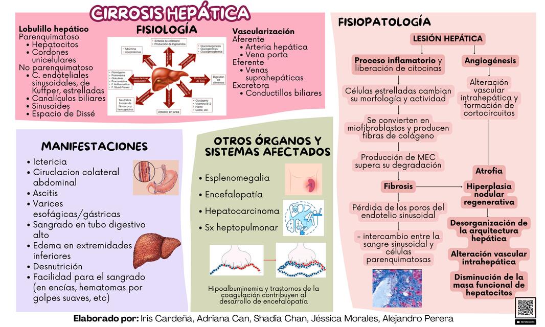 Cirrosis hepática | Alejandro Perera | uDocz