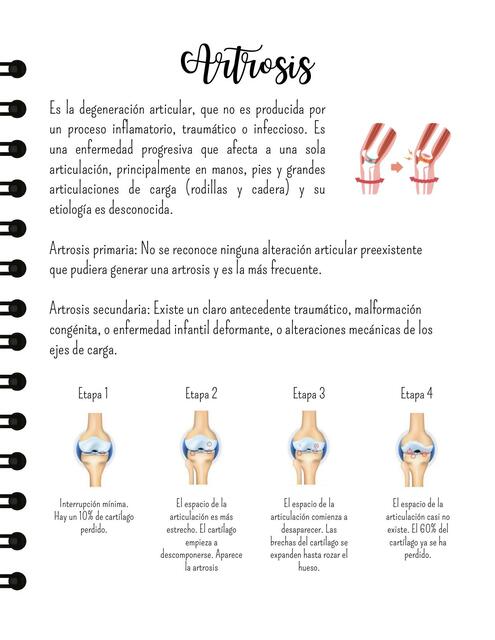 Artrosis | Emarie | uDocz