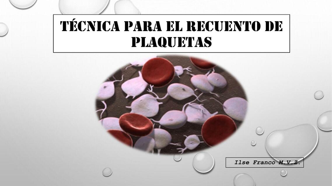 Practica 5 Recuento de plaquetas | Jaqueline Navia Cruz | uDocz Practica 5 Recuento de plaquetas | Jaqueline Navia Cruz | uDocz