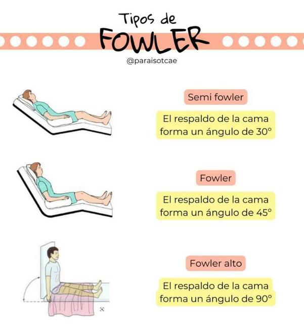 Tipos de Fowler | YUDOC.ORG | uDocz