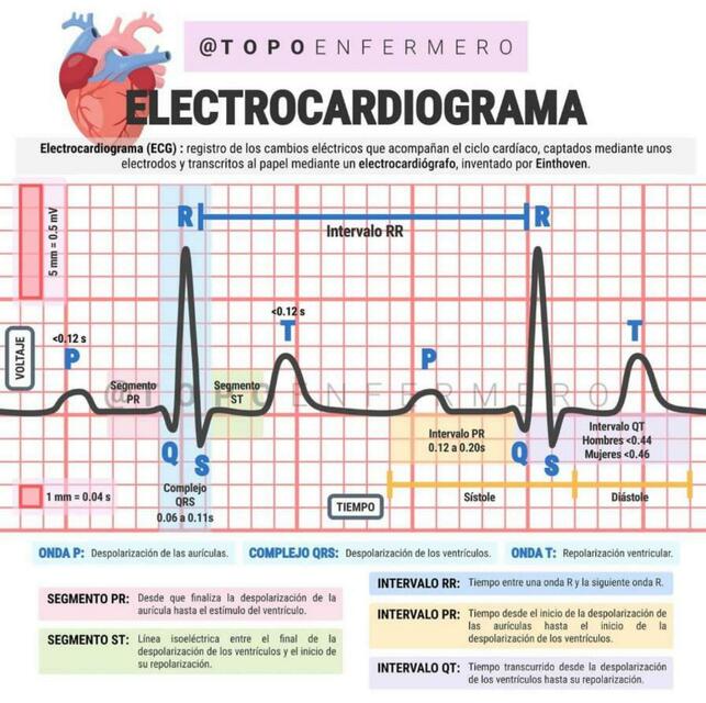 Electrocardiograma | YUDOC.ORG | uDocz