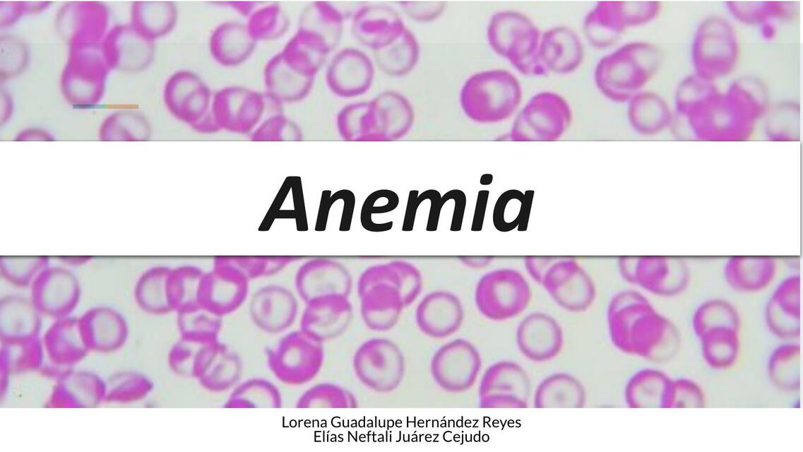 1 Anemia | Carmen Reyes Miguel | uDocz