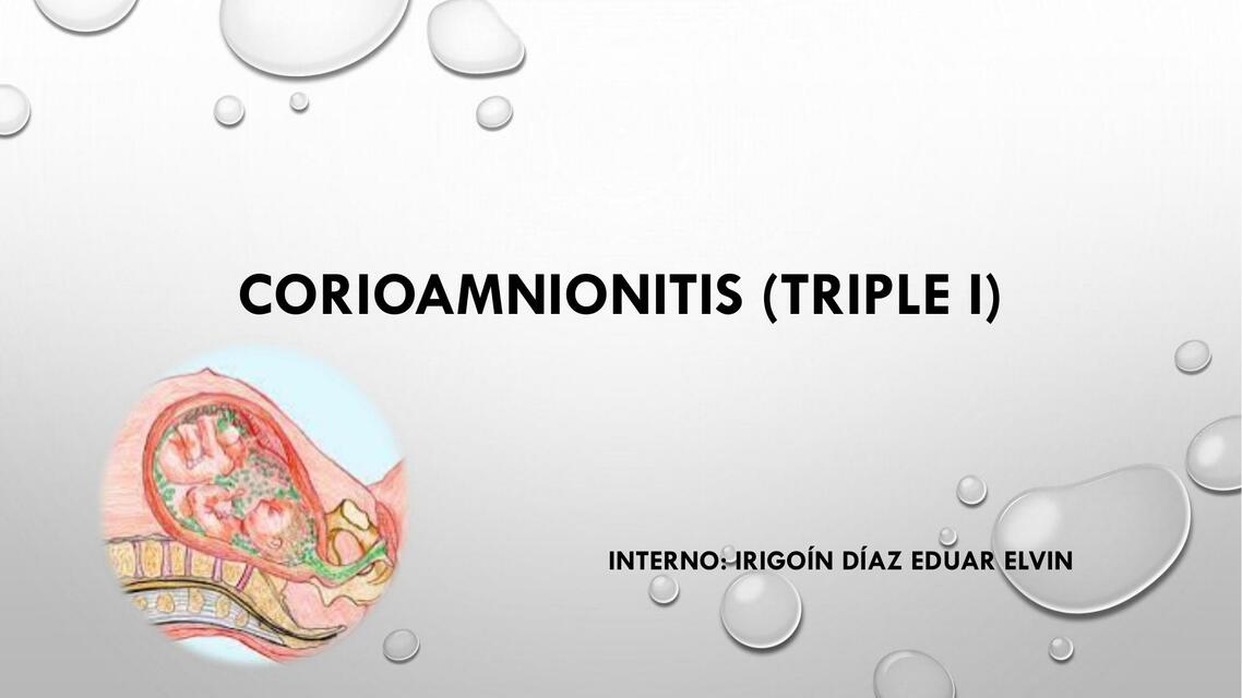 Corioamnionitis | EDUAR ELVIN | uDocz