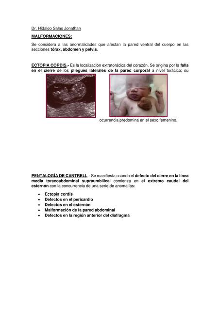 RESUMEN DE MALFORMACIONES DEL DESARROLLO DE LAS CAVIDADES CORPORALES ... RESUMEN DE MALFORMACIONES DEL DESARROLLO DE LAS CAVIDADES CORPORALES ...