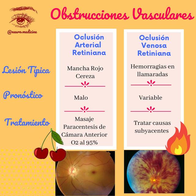 Obstrucciones Vasculares de Retina | NeuroMedicine | uDocz