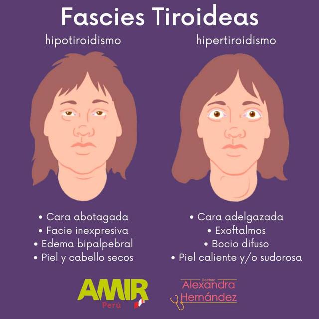 HIPO & HIPERTIROIDISMO: FASCIES | Dra Ale Herzan | uDocz