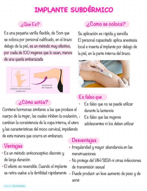 implante subdermico | Enfermería.val | uDocz