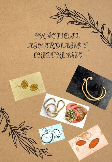 ascardiasis | Alexandra Andrea | uDocz