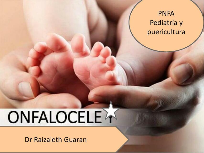 onfalo 1 | Raizaleth | uDocz