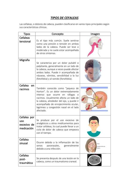 TIPOS DE CEFALEAS | Liza Stuudio | uDocz