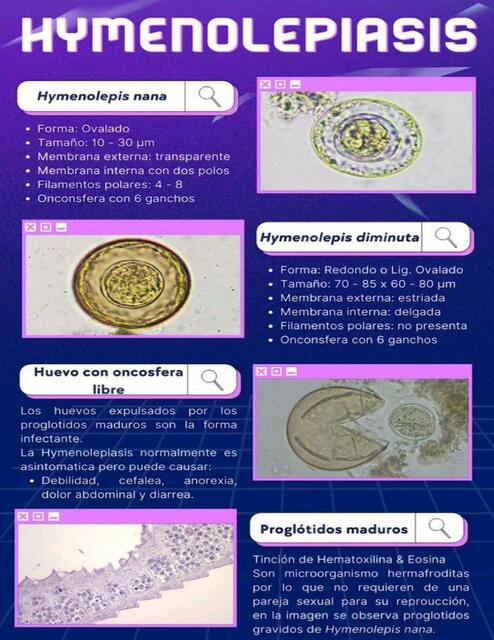 Hymenolepiasis | fraii | uDocz