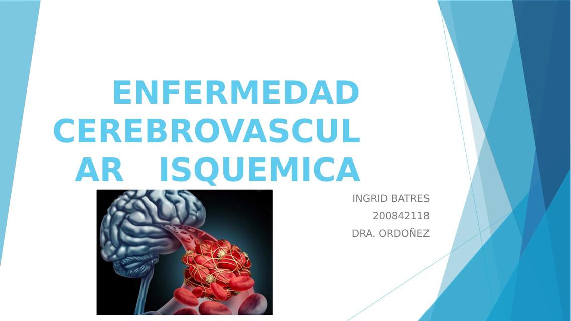 ENFERMEDAD CEREBROVASCULAR ISQUEMICA ECV | Daniela García | uDocz